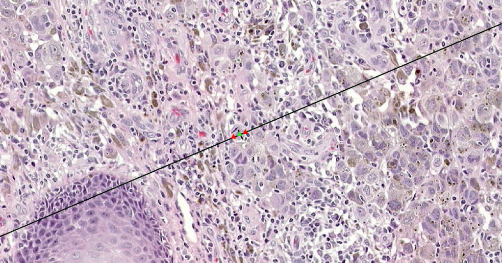 Point Sampled Intercepts – stereology.info