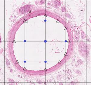 Combined Point-Intercept – stereology.info